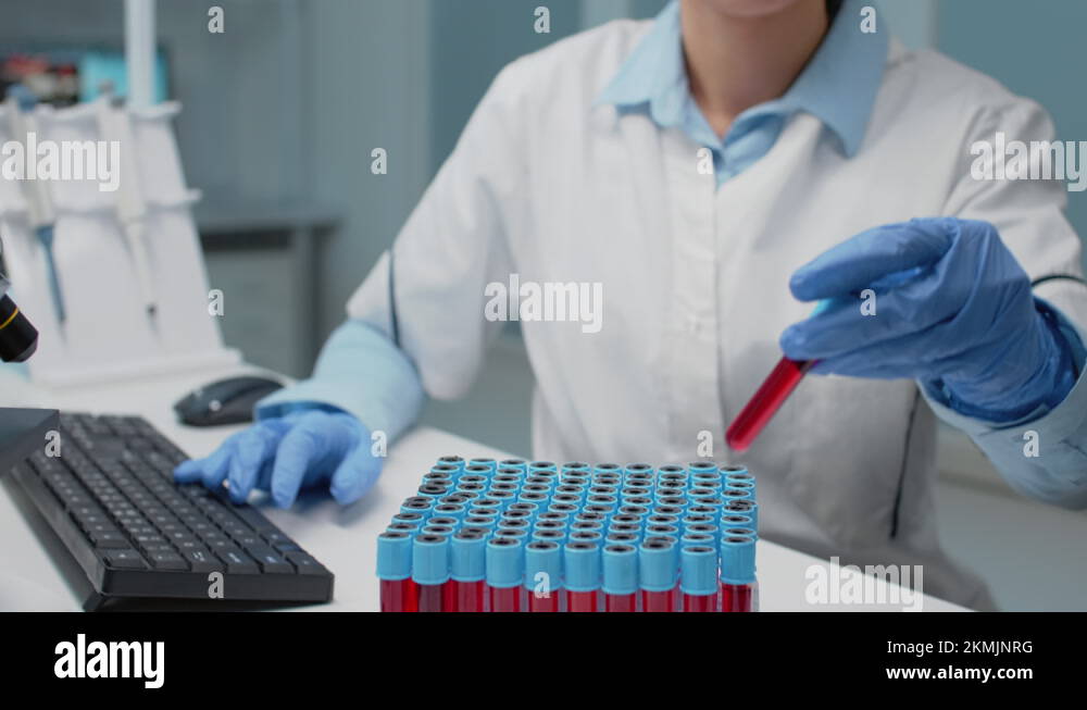 Vacutainer blood tubes Stock Videos & Footage - HD and 4K Video Clips ...