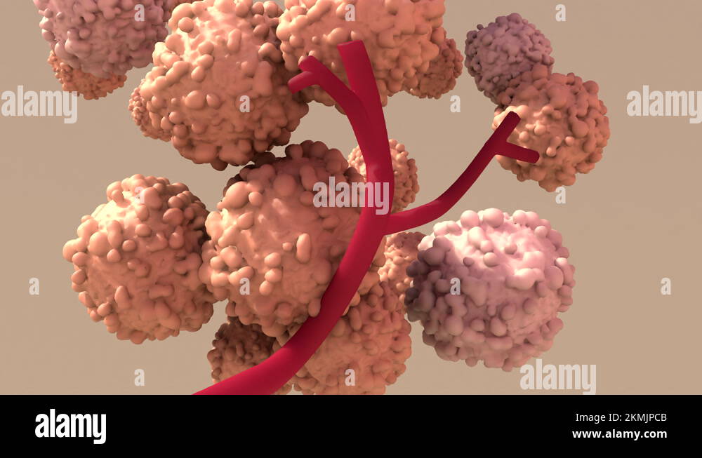 Abnormal cells Stock Videos & Footage - HD and 4K Video Clips - Alamy