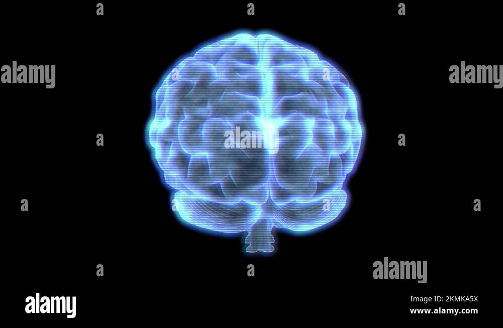 Bad brain Stock Videos & Footage - HD and 4K Video Clips - Alamy