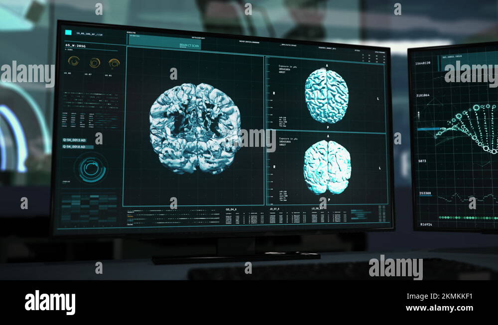 Hospital brain scans Stock Videos & Footage - HD and 4K Video Clips - Alamy
