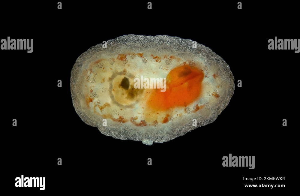 Pentacula Holothuroidea larva, Juvenile sea cucumber under microscope ...