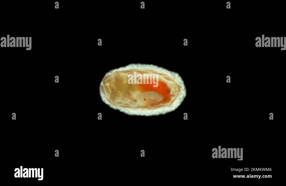 Pentacula Holothuroidea larva, Juvenile sea cucumber under microscope ...