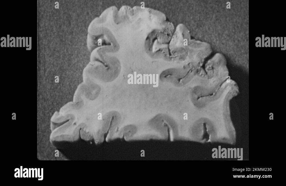 Brain matter Stock Videos & Footage - HD and 4K Video Clips - Alamy