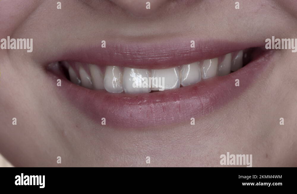 Beautiful mouth smile teeth Stock Videos & Footage - HD and 4K Video ...