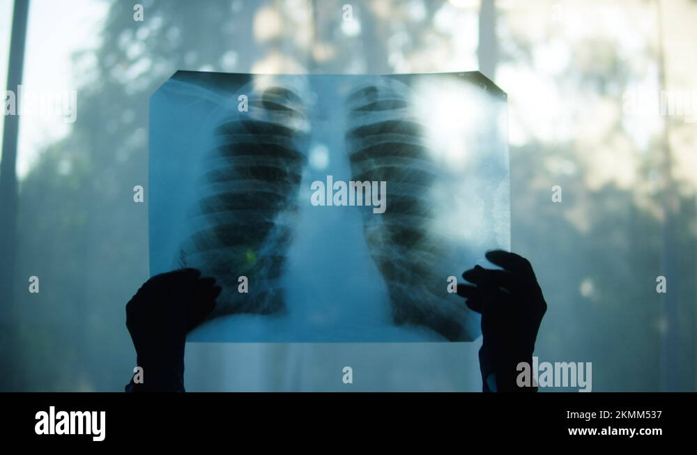 Holding X-ray image of human chest on window background, doctor ...