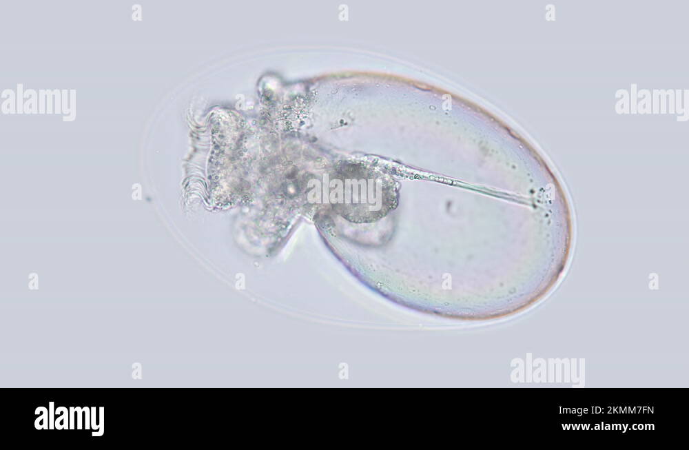 Egg with Mollusca Nudibranchia embryos under a microscope Stock Video ...