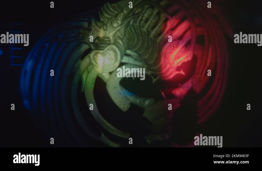 Magnetic resonance imaging (MRI) of the human chest with ribs and spine ...