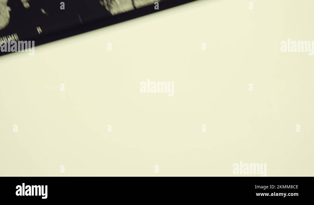 Magnetic resonance imaging (MRI) of the human chest with ribs, spine ...