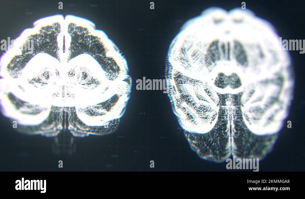 Brain scan animation. Vital signs are displayed on hi tech hospital ...