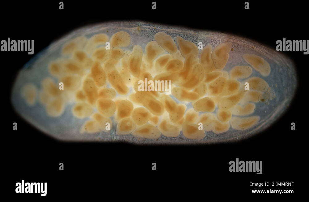 Young Nemertea worms in a clutch of eggs under a microscope Stock Video ...