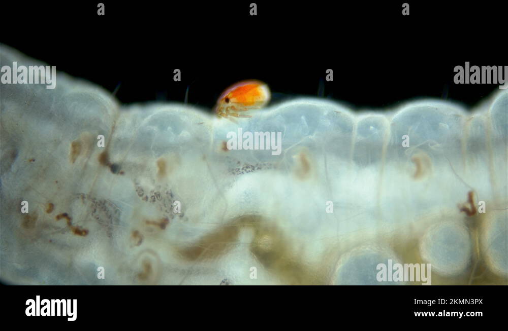 Larva mite Hydrachnidia and Hydrophilidae larva under a microscope ...
