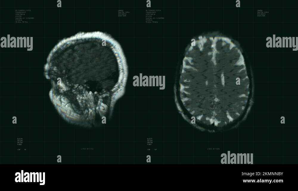 Brain scan visualization animation. Diagnosis data on laboratory ...