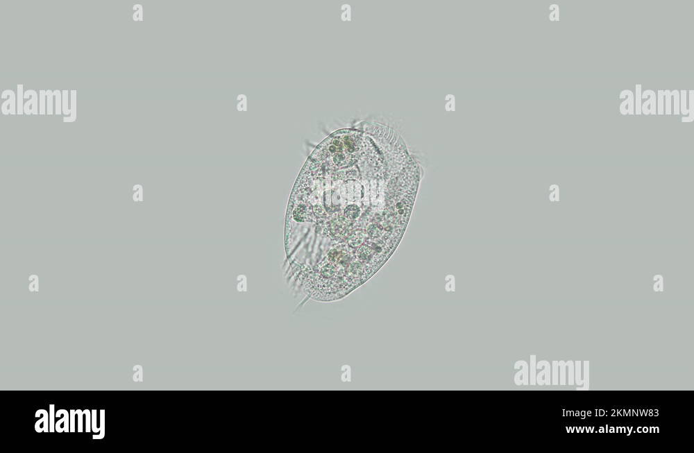 infusorium Ciliophora Subclass Hypotrichia under a microscope Stock ...