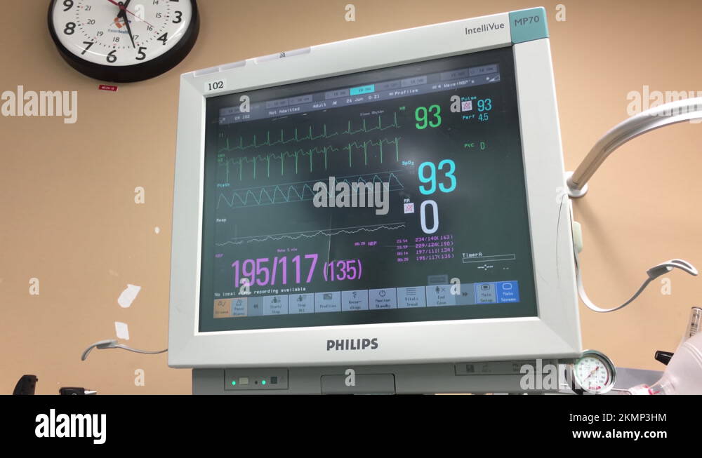 Ecg blood pressure monitoring Stock Videos & Footage - HD and 4K Video ...