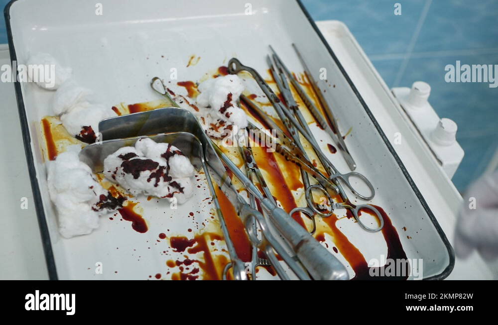 Medical utensils operation Stock Videos & Footage - HD and 4K Video ...