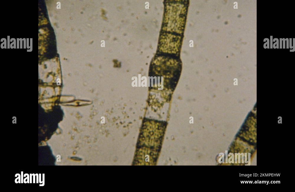1950s Microscopic View Of Algae Cells Sexually Reproducing Person