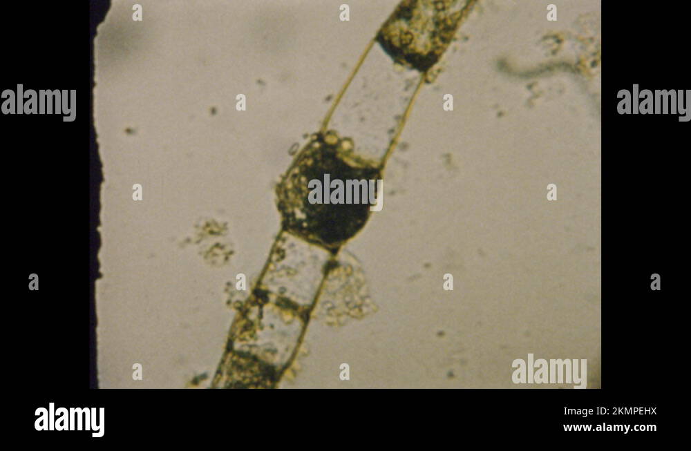 1950s: Microscopic view of egg cells on algae cell chain. New cell ...