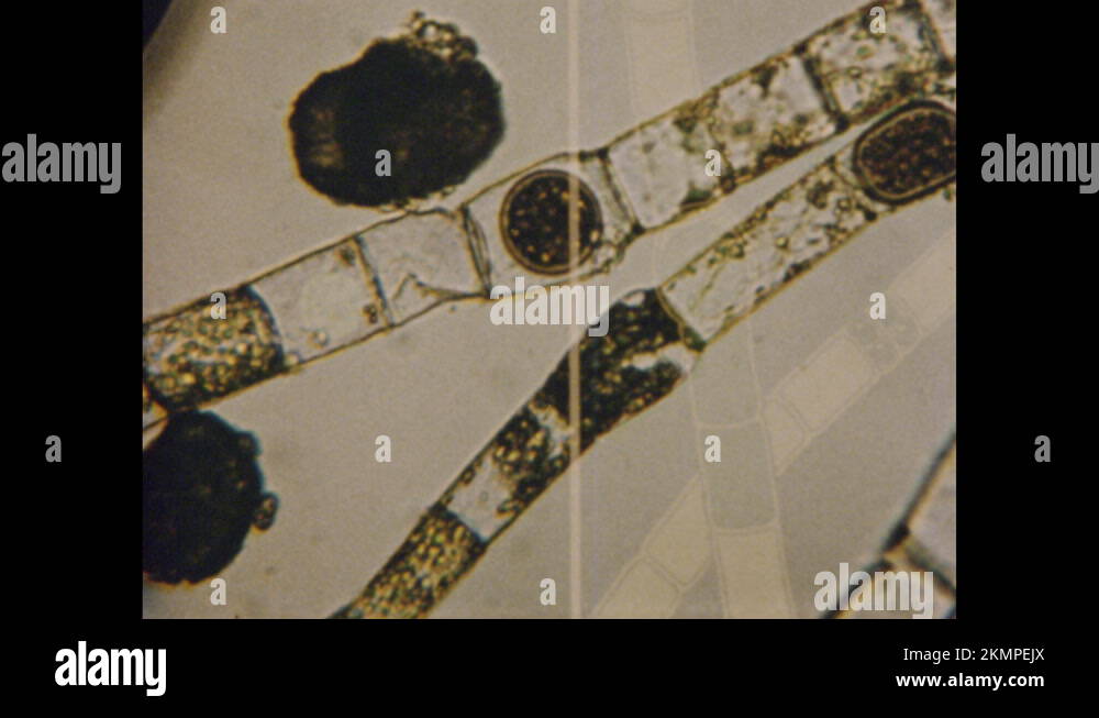 1950s: Microscopic view of algae cells. Animation of sexual and asexual ...
