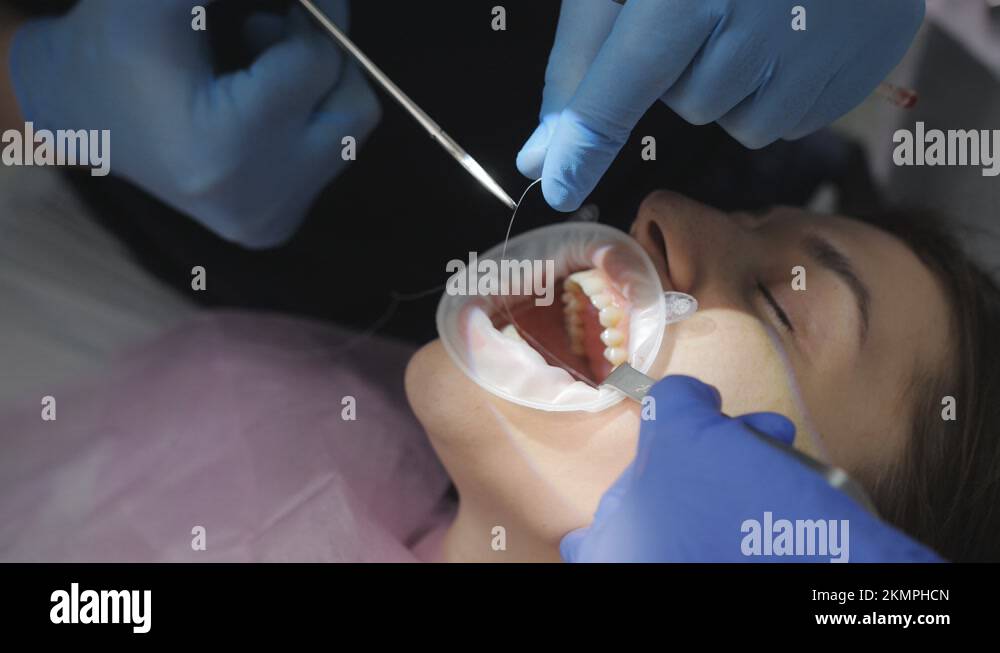 The dentist sutures the gum at the site of the removed tooth in the ...