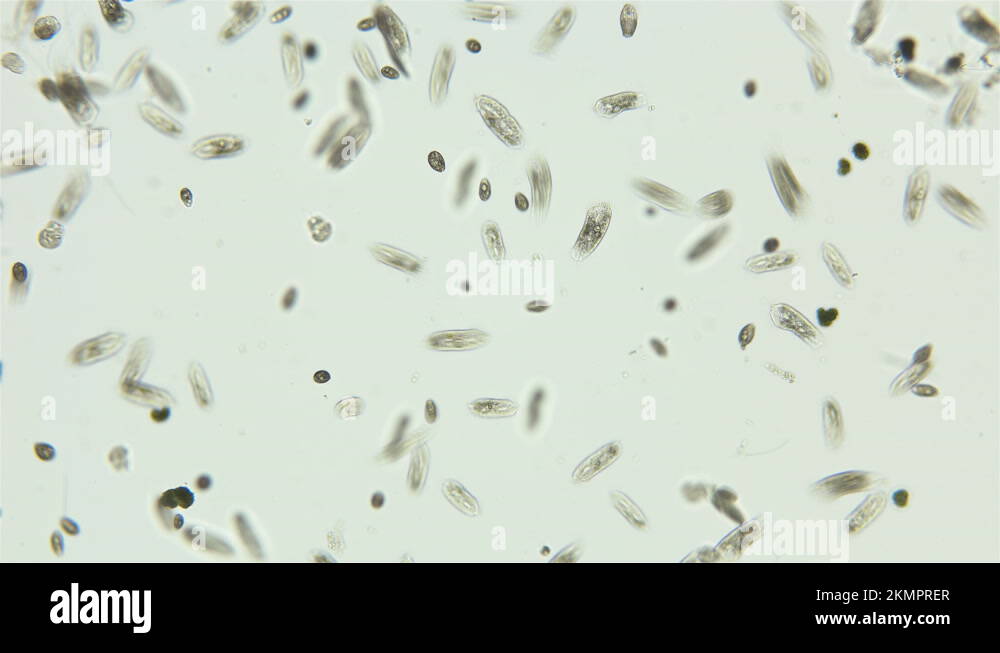 Infusorium colony Ciliophora Hypotrichia and Coleps under a microscope ...