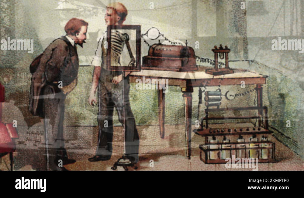 Roentgen x rays Stock Videos & Footage - HD and 4K Video Clips - Alamy