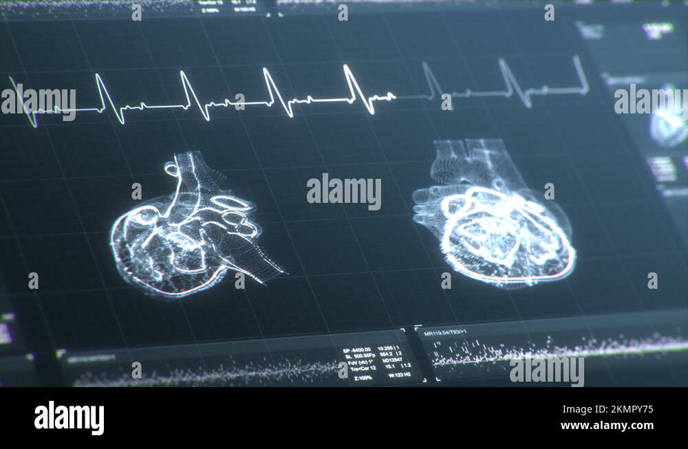 Dynamic pulsating heart. Heart beat line. Cardiogram signal monitoring ...