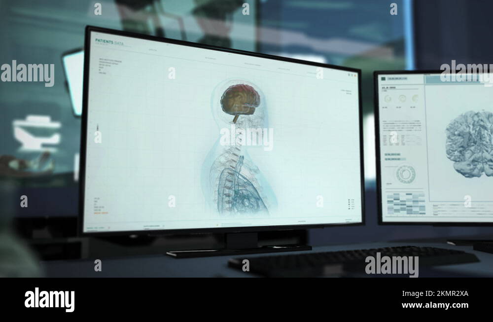 Diagnostic software is scanning the human brain at the modern medical laboratory Stock Video ...