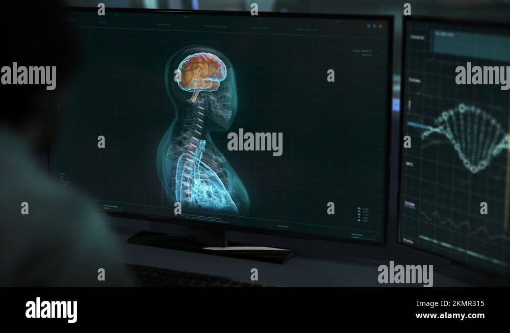 Patients Brain Anatomy Diagnosis Via Rotating Interface Computer System Stock Video Footage Alamy