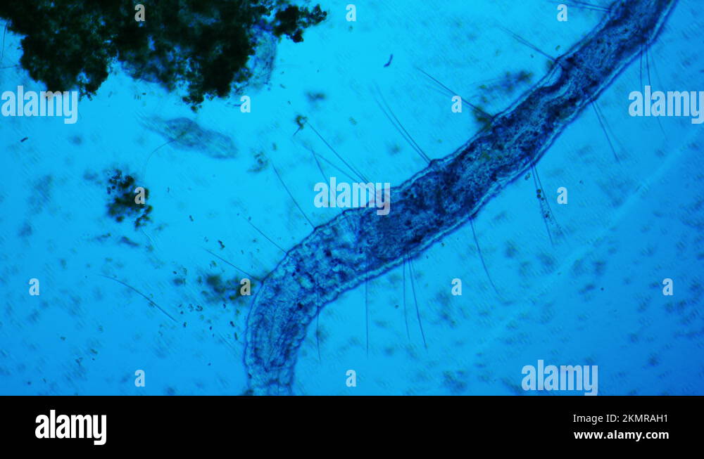 Aquatic bacteria microscope Stock Videos & Footage - HD and 4K Video ...