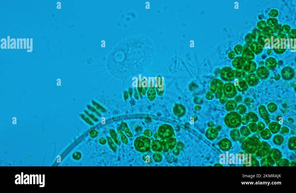 A colony of unicellular microorganisms under a microscope. Study of the ...