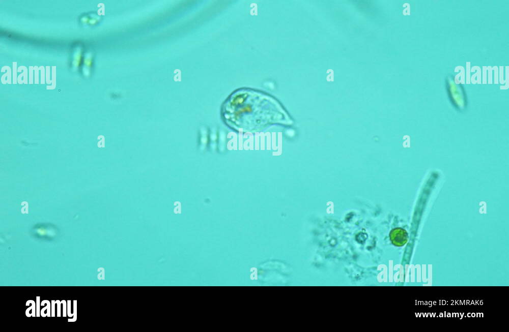 The microorganism rotates the flagellum. A drop of rainwater under a ...