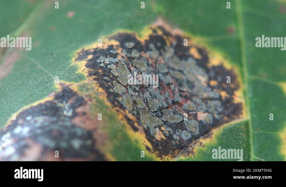 Sore spots Stock Videos & Footage - HD and 4K Video Clips - Alamy