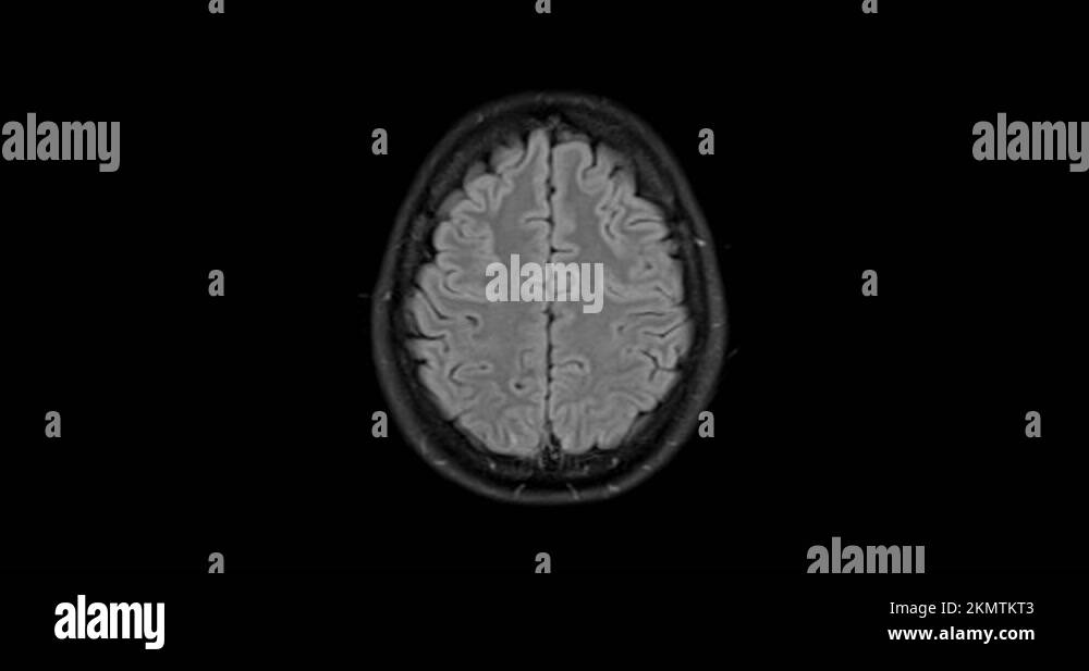 Vertical projection Stock Videos & Footage - HD and 4K Video Clips - Alamy