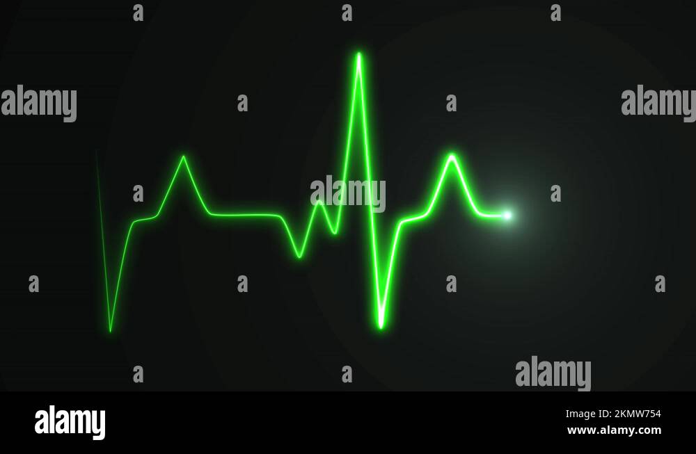 Glow heartbeat medical cardiogram. Pulse trace green line on black ...