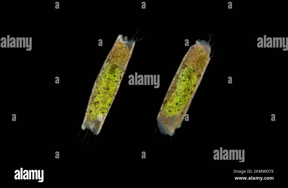 Trichoptera larva under a microscope, family Hydroptilidae Stock Video ...