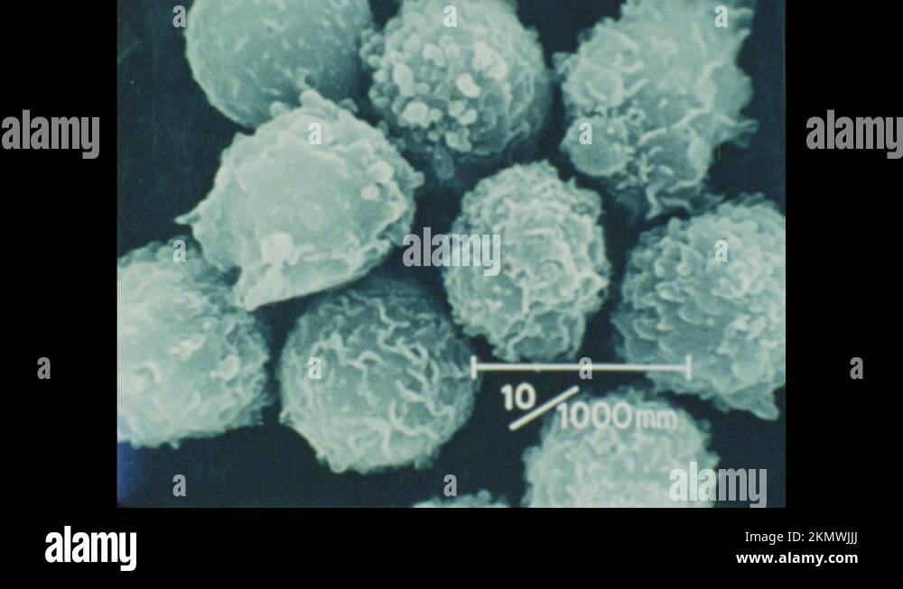 White blood cells microscope Stock Videos & Footage - HD and 4K Video ...