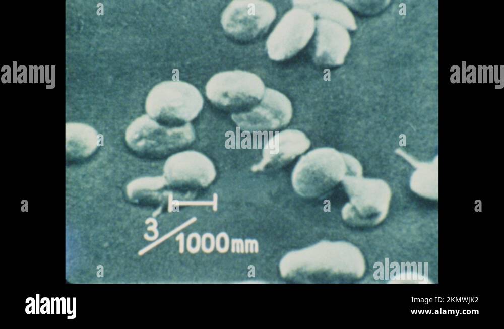 1970s: Electron microscope photo of platelets with a scale 3/1000 mm ...