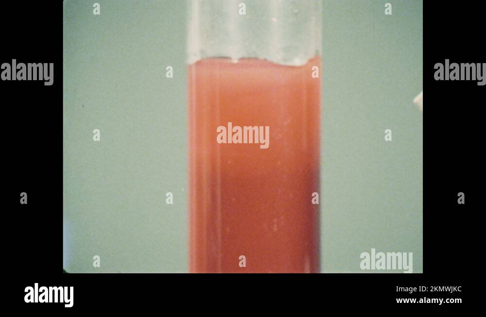 Capillary blood tube Stock Videos & Footage - HD and 4K Video Clips - Alamy