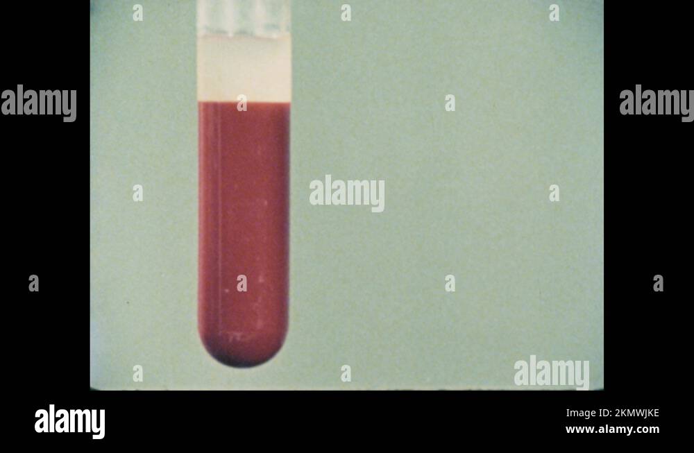 Separated blood tube Stock Videos & Footage - HD and 4K Video Clips - Alamy