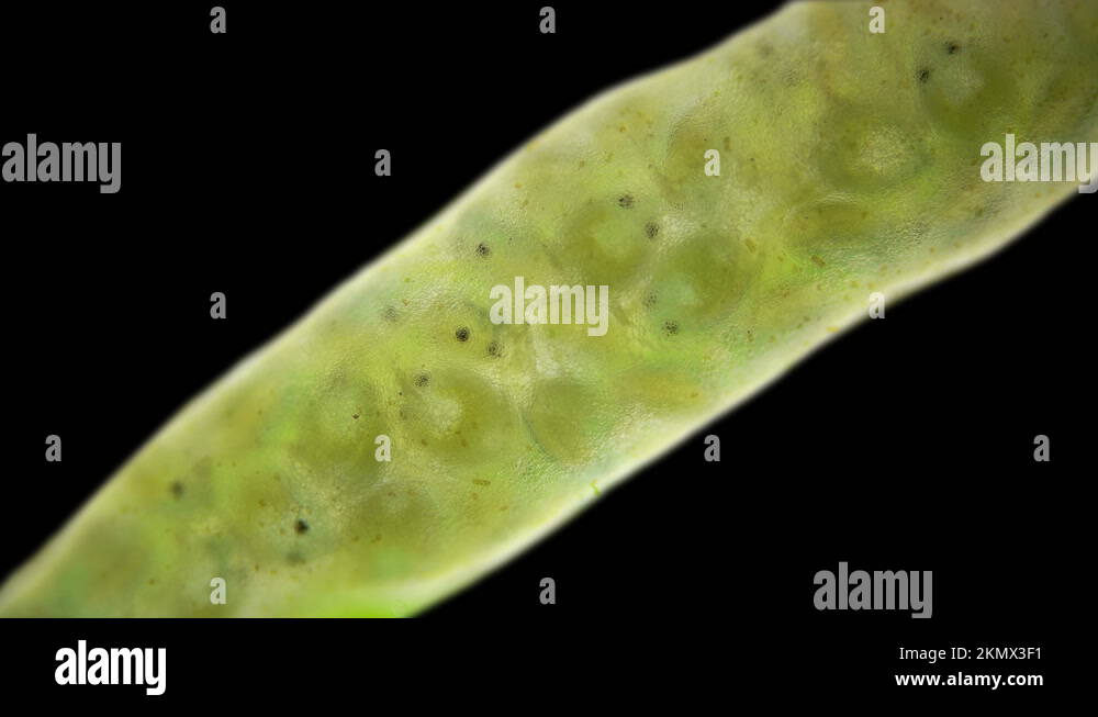Cocoon with Eggs and Larvae water mites Hydrachnidia under a microscope ...