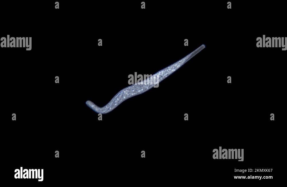 Ciliateprotists Stock Videos & Footage - HD and 4K Video Clips - Alamy