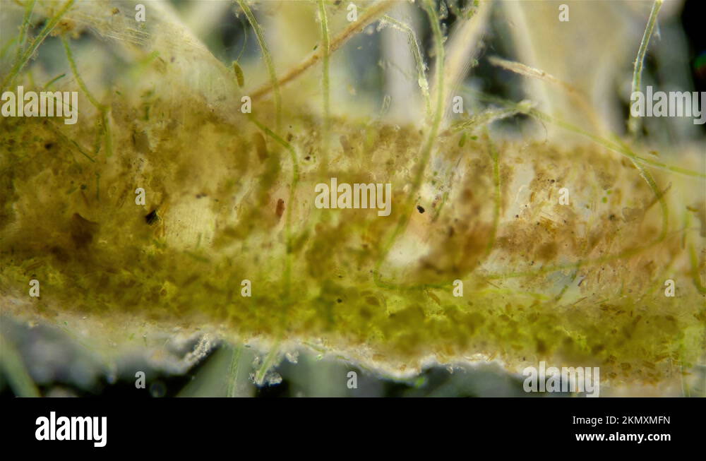 Chironomidae larva under a microscope, order Diptera Stock Video ...