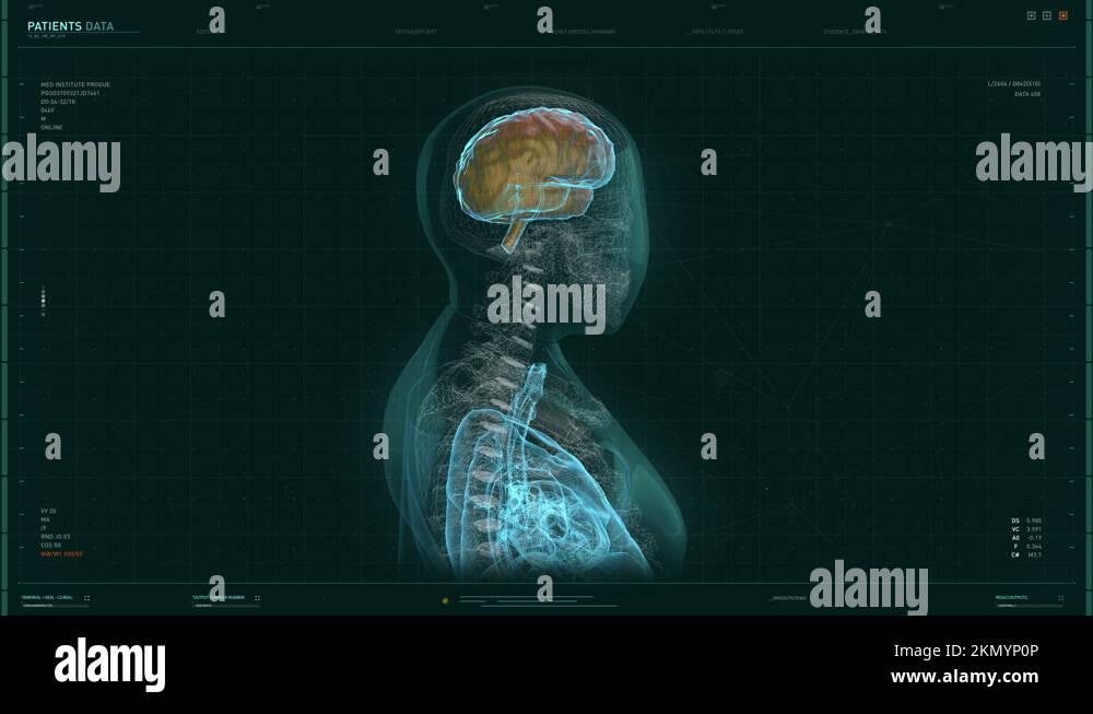 Medical Anatomy Interface Projects Human Brain Health Scan At Hospital ...