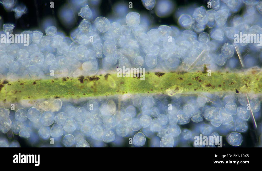 Infusoria (Ciliophora) Vorticella under microscope, class ...
