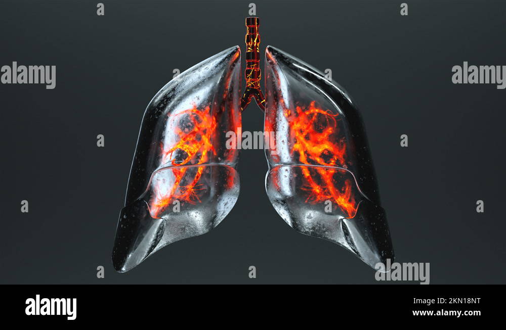 Lungs vessels Stock Videos & Footage - HD and 4K Video Clips - Alamy