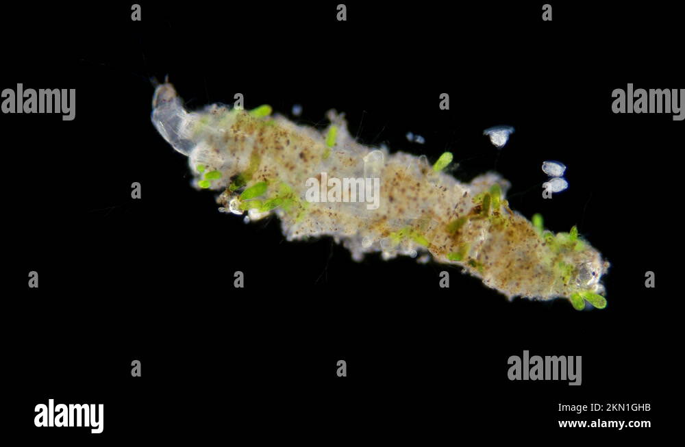 Chironomidae larva under a microscope, order Diptera Stock Video ...