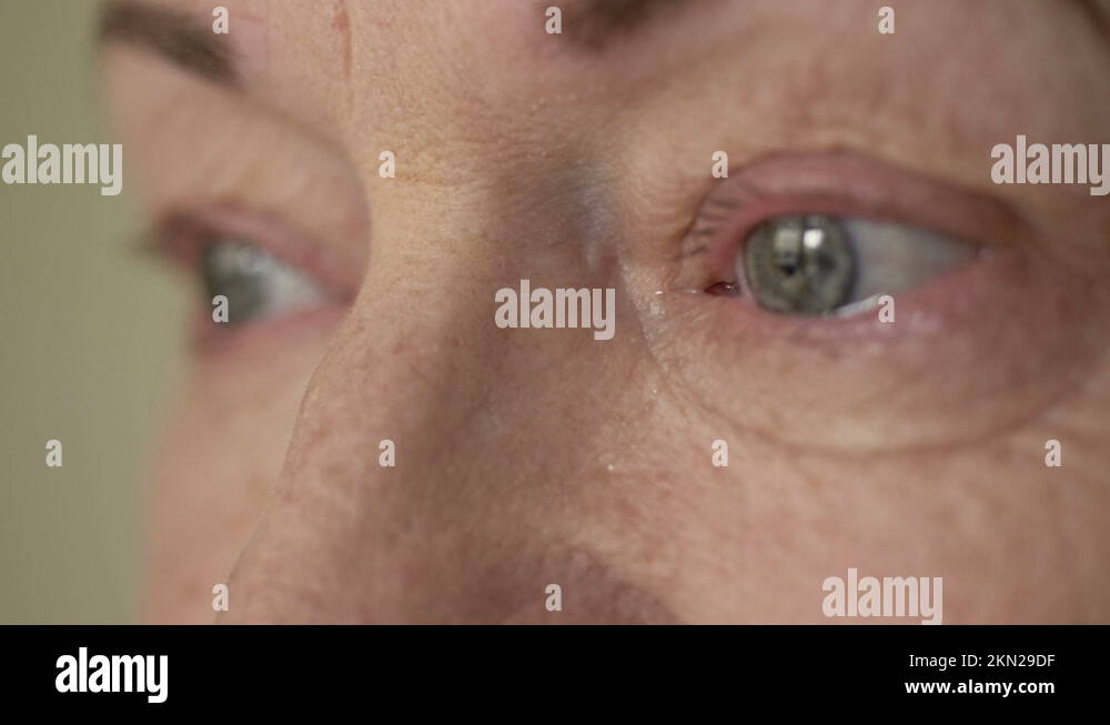 Face and eyes 60 year old bald woman. Depression and stress caused by ...