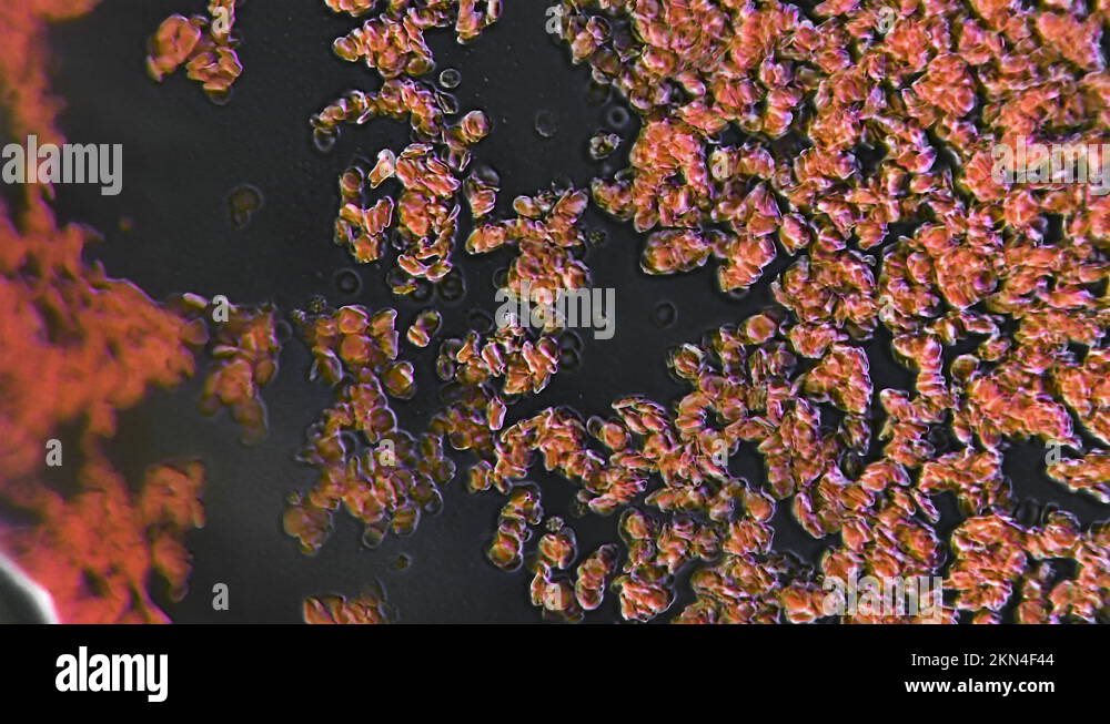 Blood clotting test Stock Videos & Footage - HD and 4K Video Clips - Alamy
