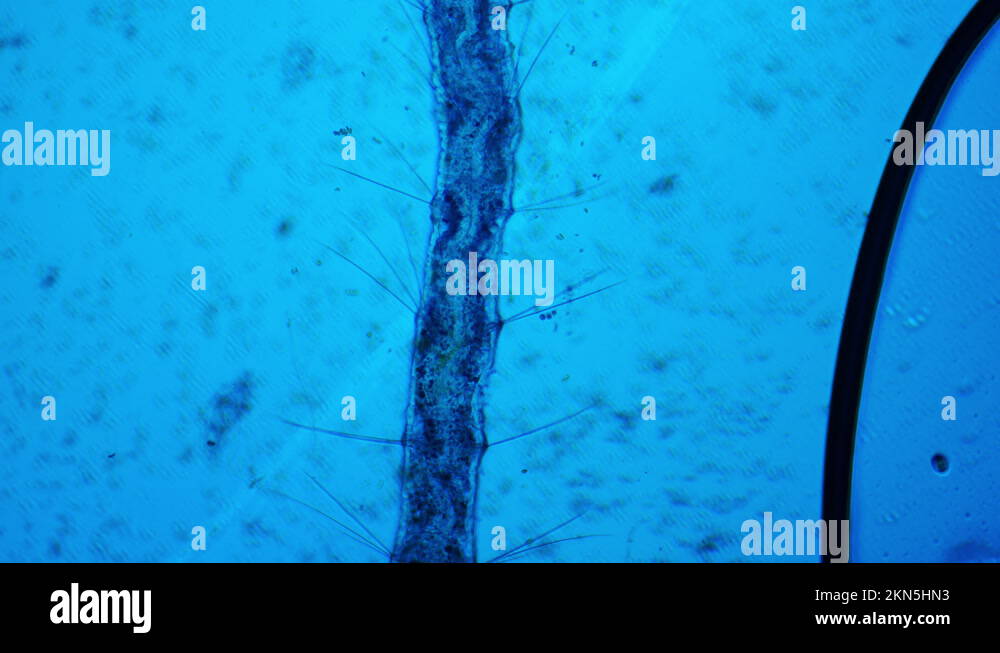 A predator hunts for microorganisms in a drop of water under a ...