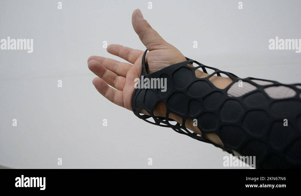 Black orthopedic plastic prosthesis printed on powder 3D printer on ...